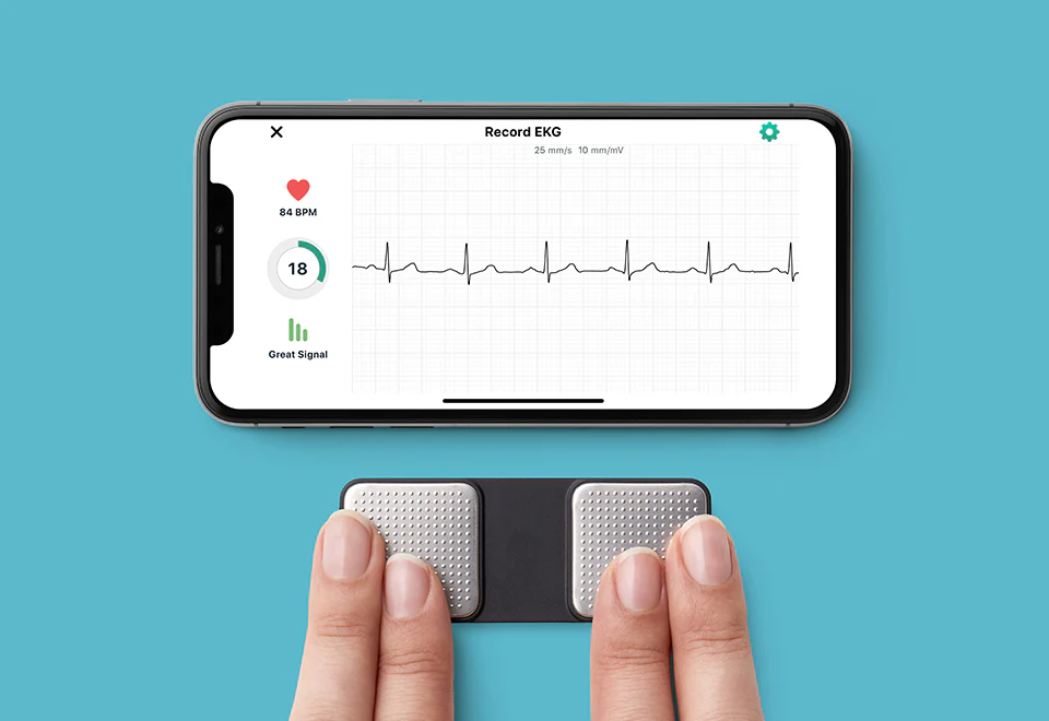 Portable EKG – srpmge